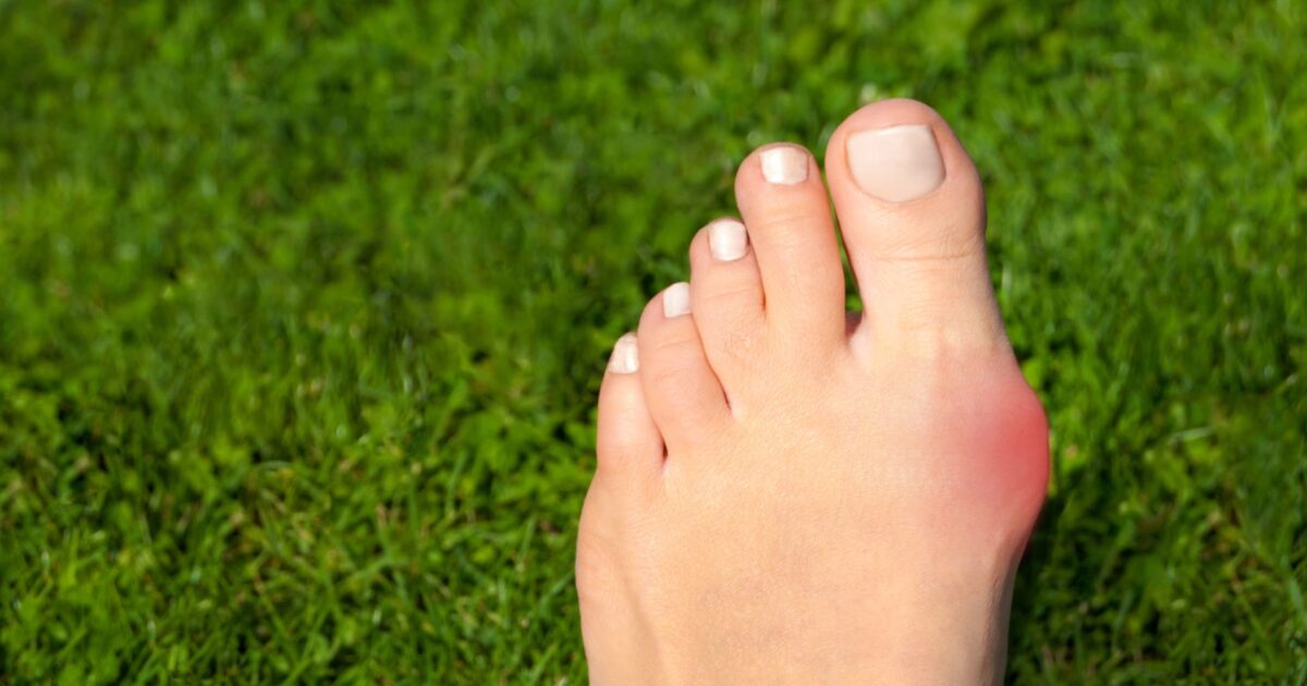 Scheve teen? Dit is mogelijk de oorzaak - Rameau